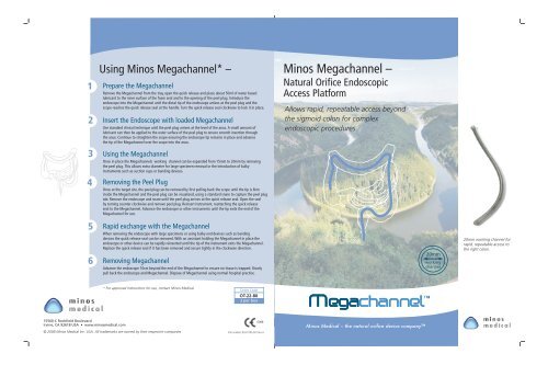 Using Minos Megachannel - Insightra Medical