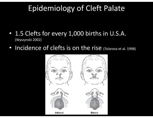 Etiology of Cleft