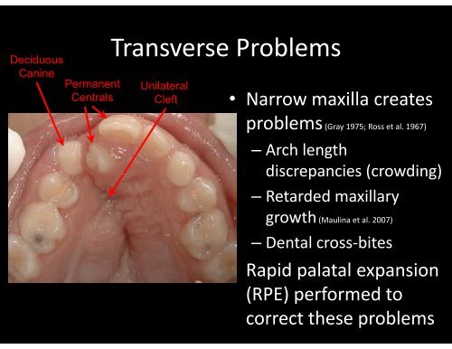 Transverse