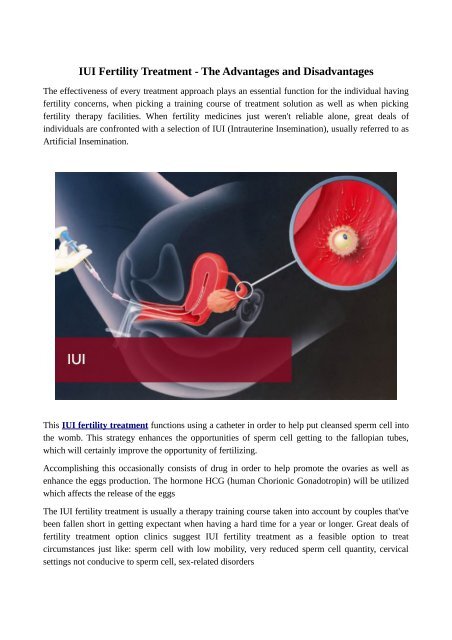IUI Fertility Treatment - The Advantages and Disadvantages