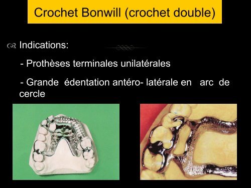 Crochet Bonwill (crochet