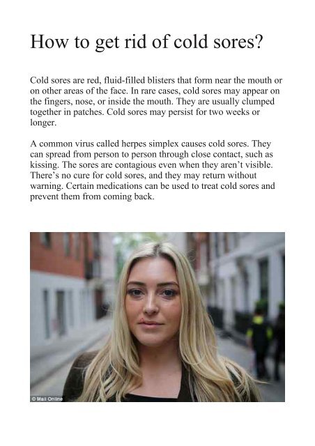 how to get rid of cold sore