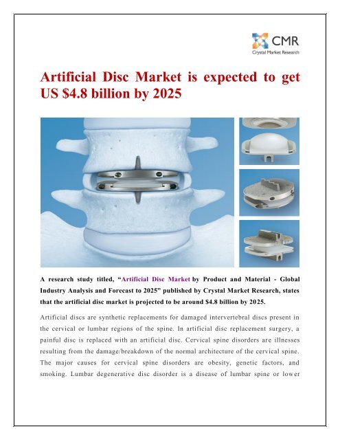 Artificial Disc Market