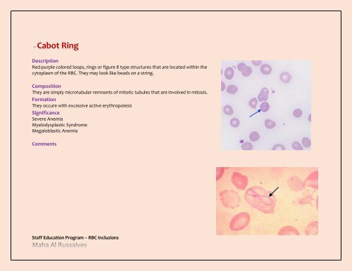 Cabot Ring Descriptio