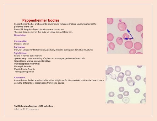 Pappenheimer bodies Pappe