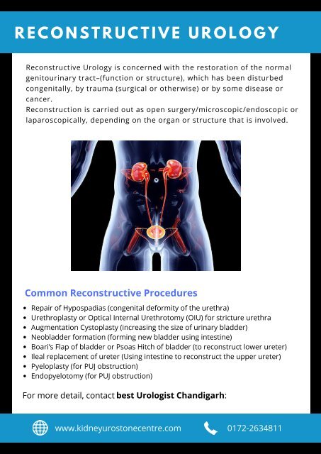 Reconstructive Processes