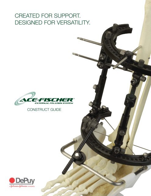 Ace-Fischer® Surgical Technique - Biomet