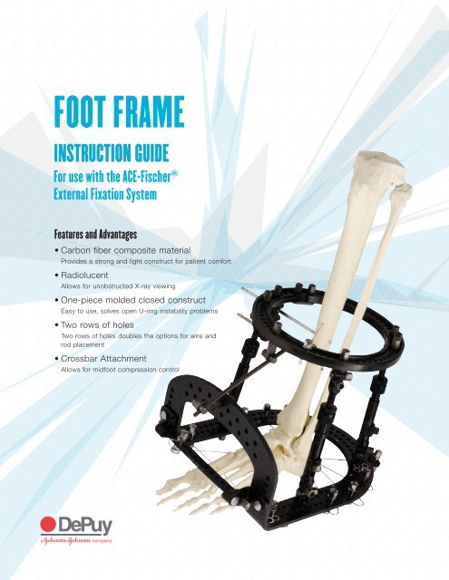 Ace-Fischer® Foot Frame Sales Sheet - Biomet