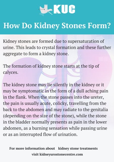 How do kidney stones form? | Kapoor’s Kidney & Urostone Centre
