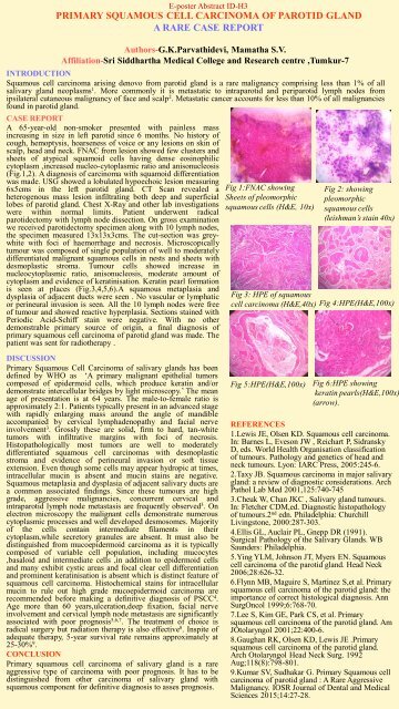 KAPCON 2018 e-poster Primary SCC of parotid gland.pdf