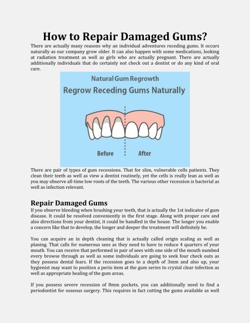 How to Repair Receding Gums At Home