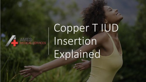 Copper T IUD Insertion Explained