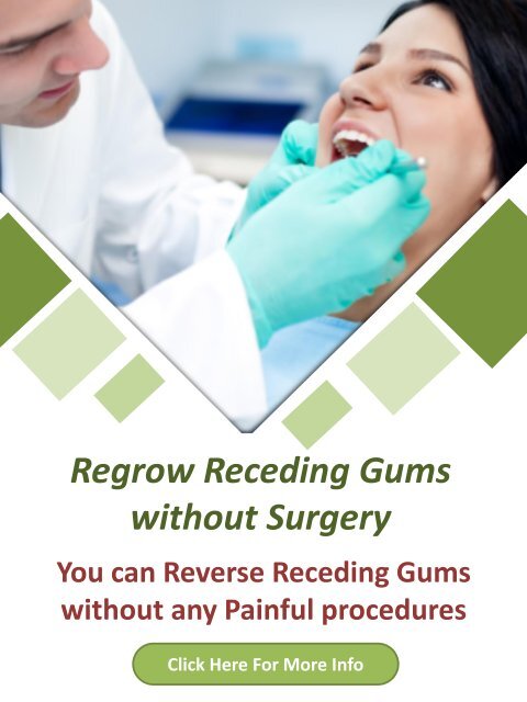 How to Reverse Receding Gums Without Surgery