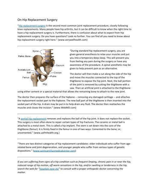 On Hip Replacement Surgery