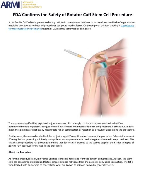 FDA Confirms the Safety of Rotator Cuff Stem Cell Procedure