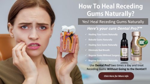 Heal Gums Naturally