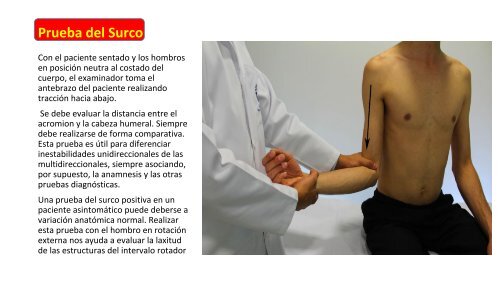 Prueba del Surco Con el p