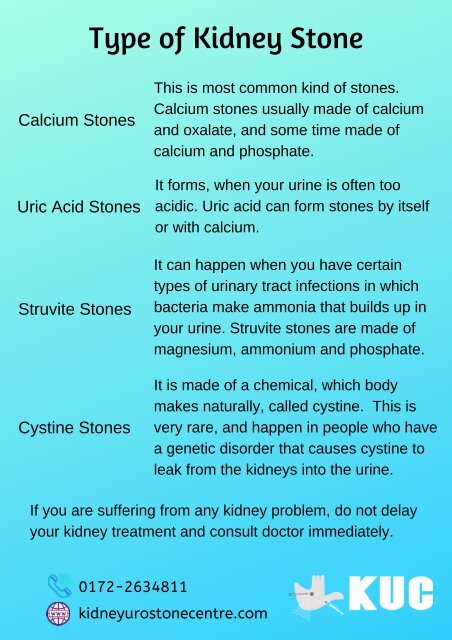 Struvite Kidney Stones