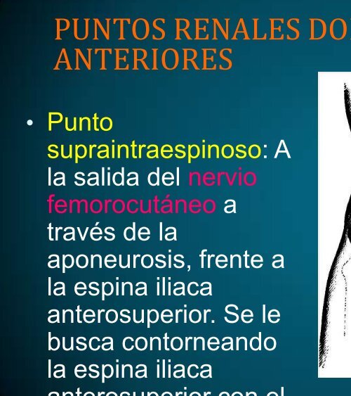 PUNTOS RENALES DOLOROSOS