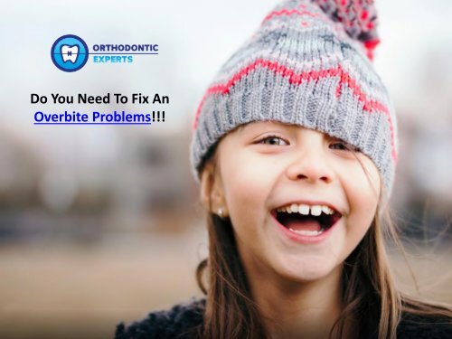 Overbite Treatment Options | Orthodontic Experts