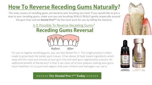 Reverse Receding Gums Naturally