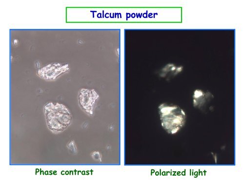 Talcum powder Phase contr
