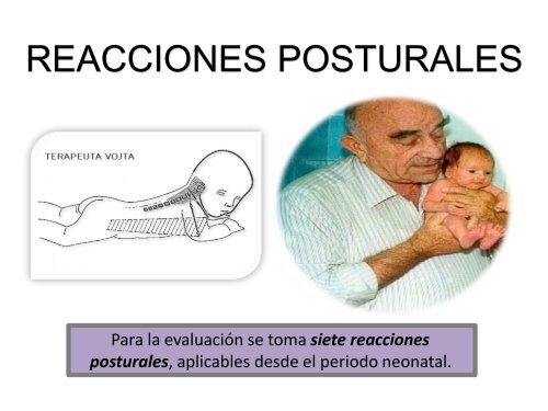 REACCIONES POSTURALES
