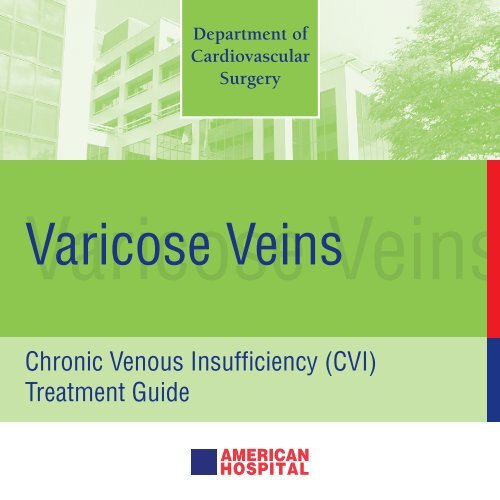 Varicose Veins Chronic Venous Insufficiency Cvi Treatment Guide