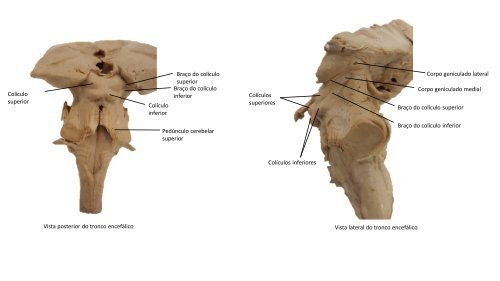 Colículo superior Colíc