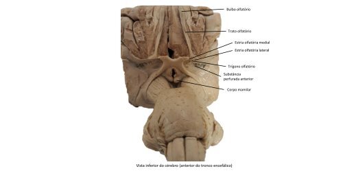 Bulbo olfatório Trato ol