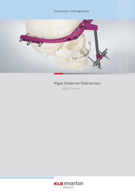 Rigid External Distraction - KLS Martin