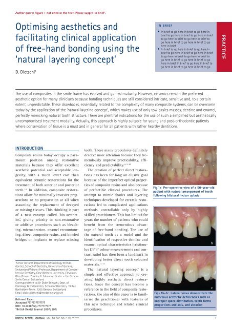 natural layering concept - edudent international