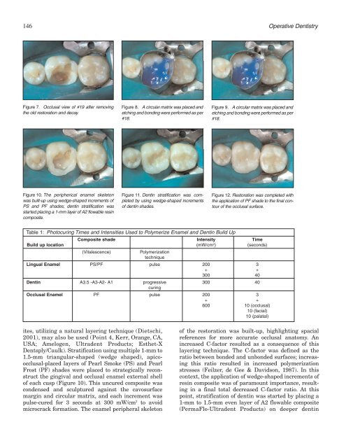 146 Operative Dentistry F