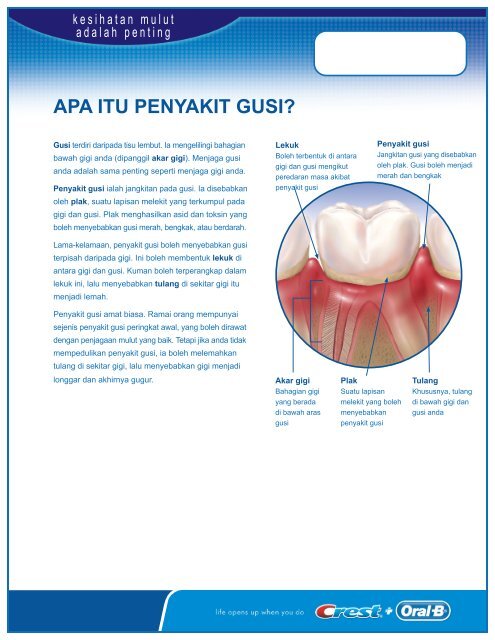 APA ITU PENYAKIT GUSI? - DentalCare.com