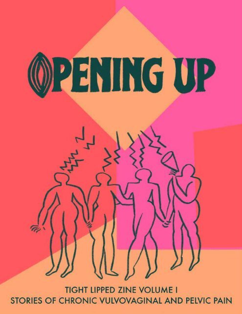 Opening Up