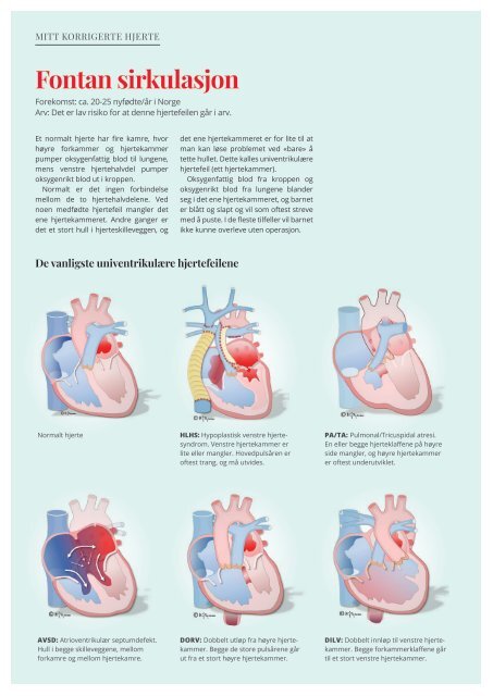 6_Fontan-sirkulasjon