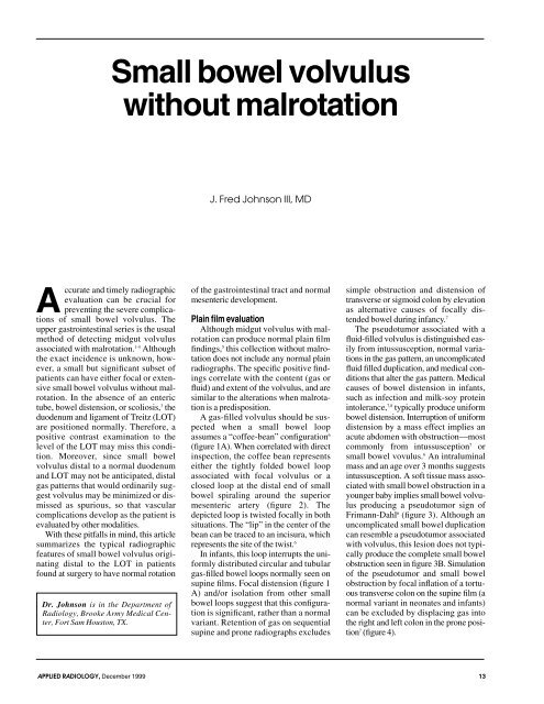 Small bowel volvulus without malrotation - Applied Radiology Online