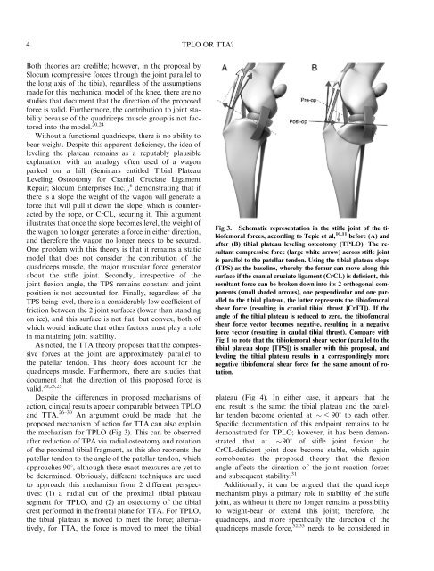 4 TPLO OR TTA? Both the