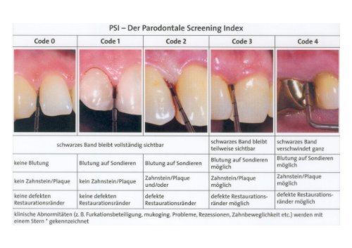 PSI-Index