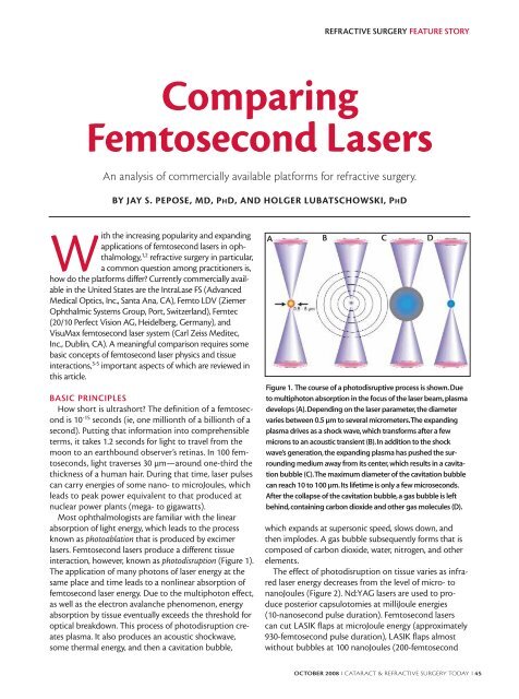 Comparing Femtosecond Lasers - Cataract & Refractive Surgery ...