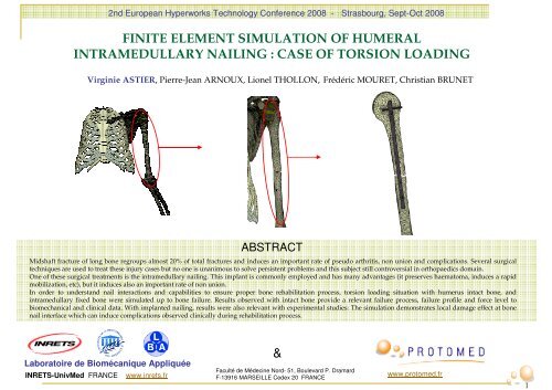 finite element simulation of humeral intramedullary nailing