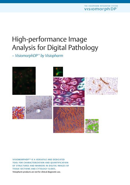 High-performance Image Analysis for Digital Pathology - Visiopharm