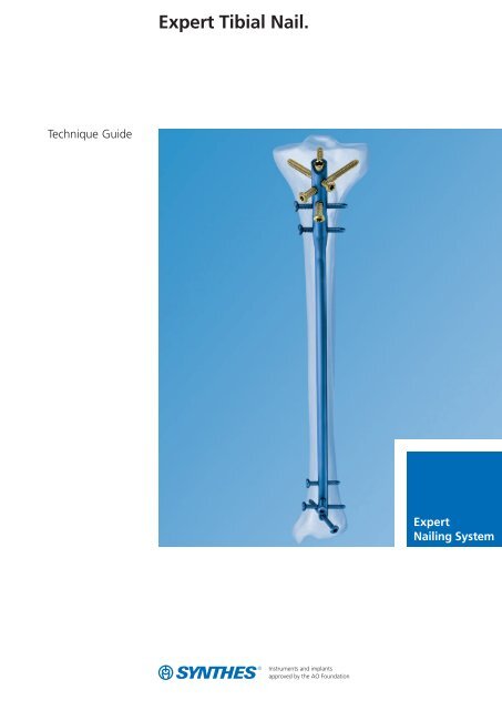 Expert Tibial Nail. - Synthes