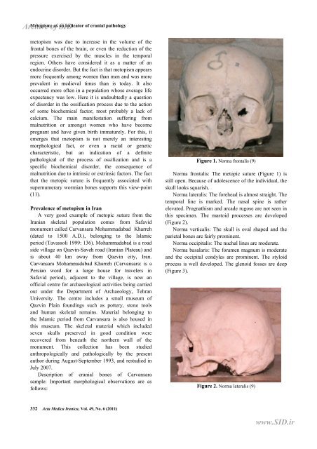 Archive of SID Metopism: