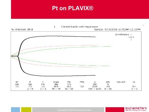 Pt on PLAVIX® Copyright