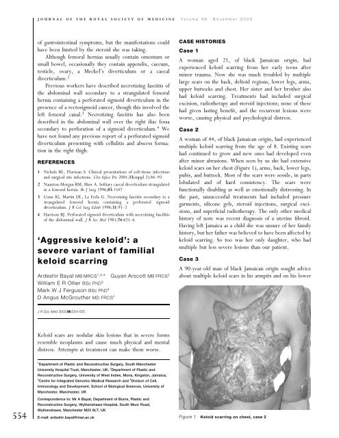 'Aggressive keloid': a severe variant of familial keloid scarring