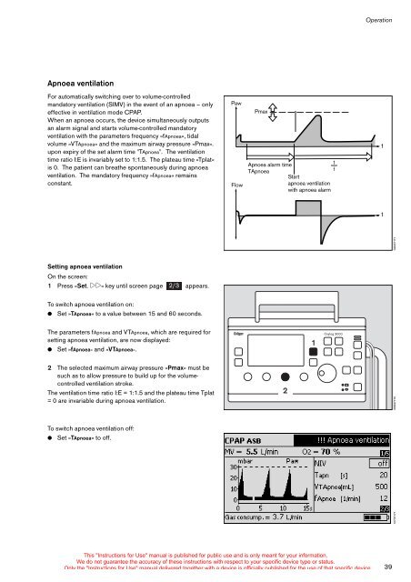 Operation CPAP, CPAP/ASB