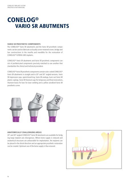CONELOG ® IMPLANT SYSTEM