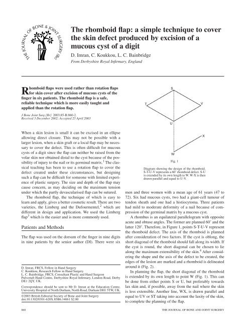 Hand The rhomboid flap - The Bone & Joint Journal