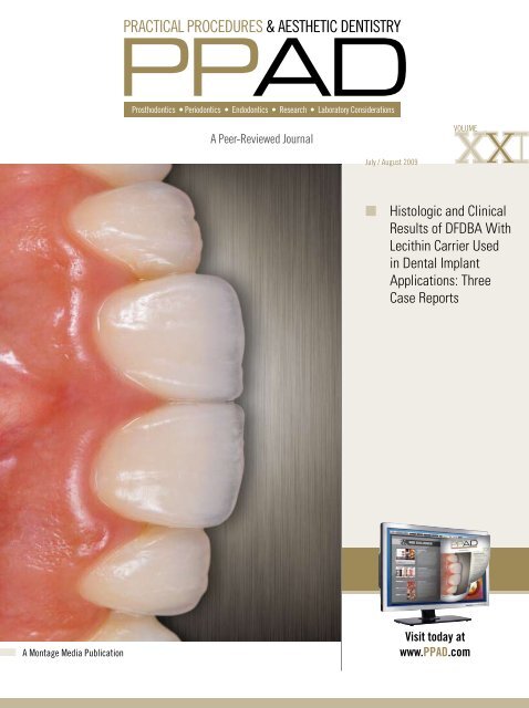 Histologic and Clinical Results of DFDBA With Lecithin ... - BIOMET 3i